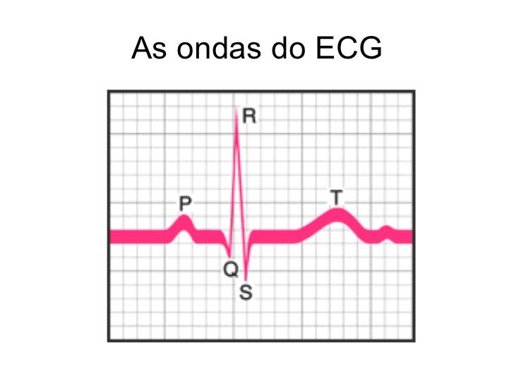 ECG NORMAL