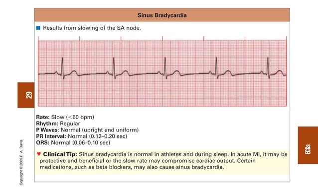 ECG_Notes_Jones.pdf