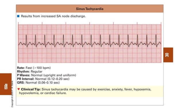ECG_Notes_Jones.pdf