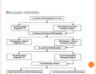 wide complex tachycardia | PPTX