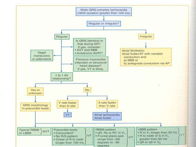 wide complex tachycardia | PPTX | Heart and Cardiovascular Diseases ...