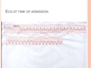 wide complex tachycardia | PPTX