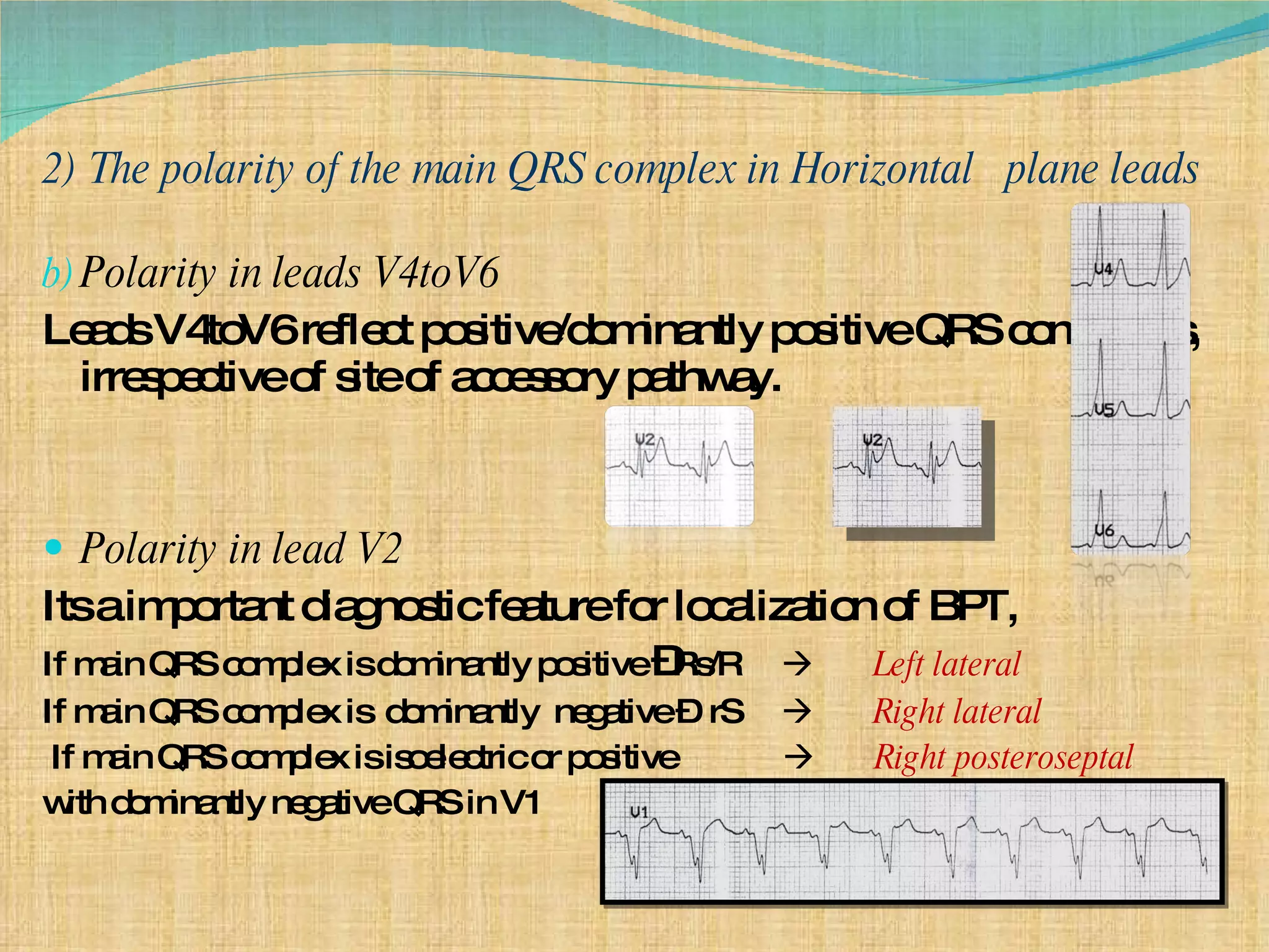 ECG: Wolff-Parkinson-White syndrome | PPT