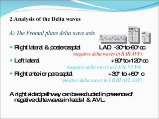 ECG: Wolff-Parkinson-White syndrome | PPT