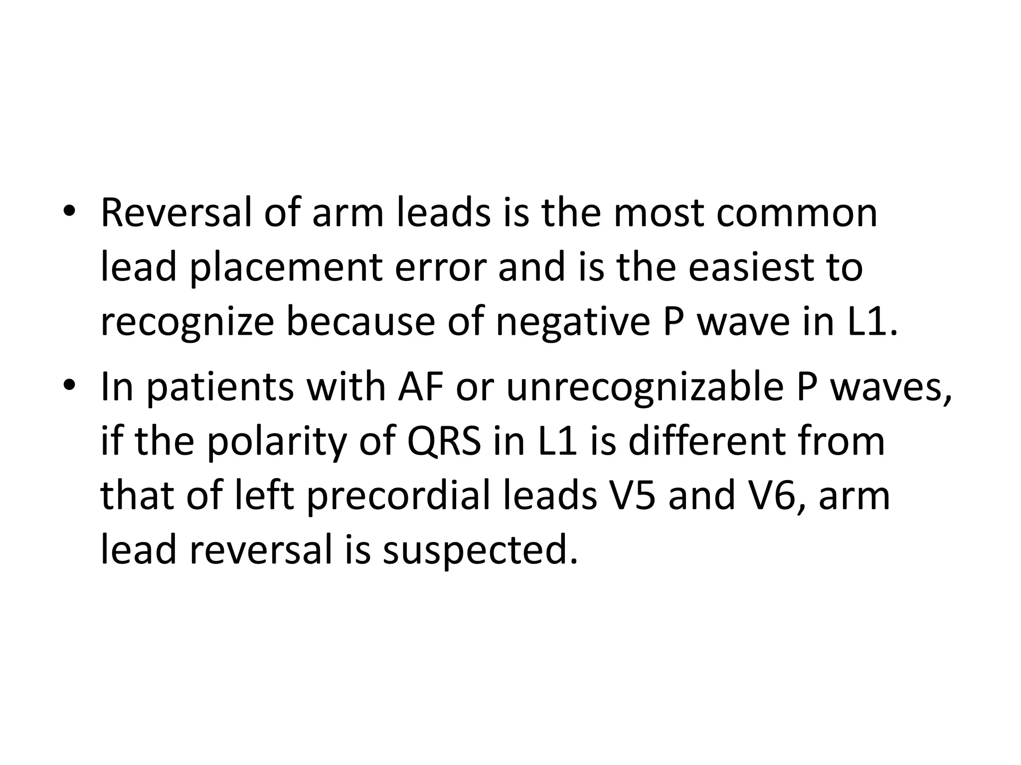 ECG: Reversal of limb leads | PPTX