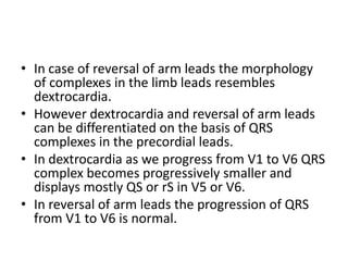 ECG: Reversal of limb leads | PPTX