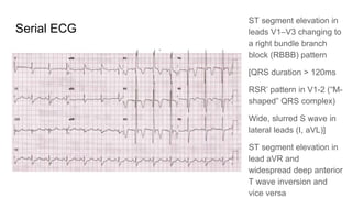 ECG of the weeks | PPTX