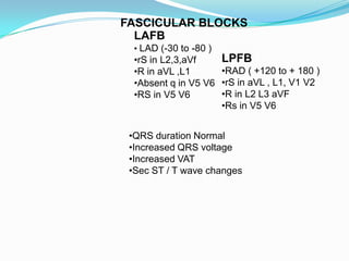 ECG: Trifascicular Block | PPTX