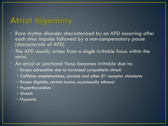 ECG: Atrial Bigeminy | PPT