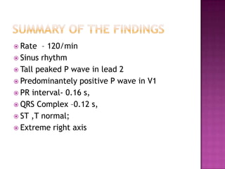 ECG: Congenital Heart Disease | PPTX