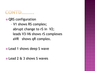 ECG: Congenital Heart Disease | PPTX