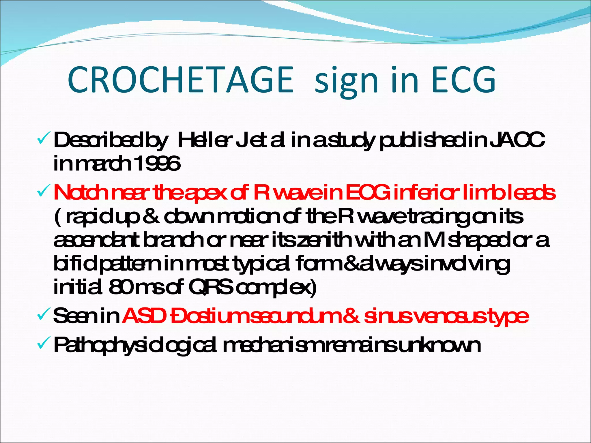 ECG: Crochetage sign | PPT