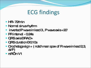 ECG: Crochetage sign | PPT