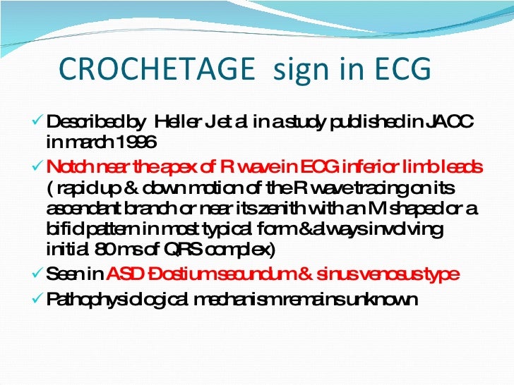 ECG: Crochetage sign