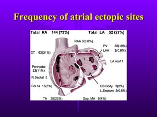 ECG: Coronary Sinus Rhythm | PPT