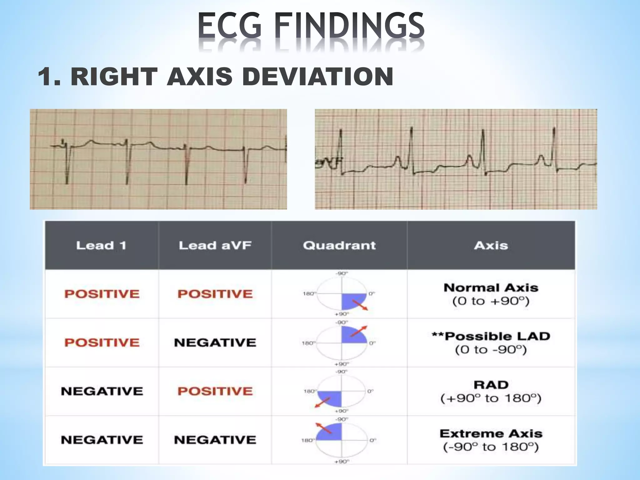 ECG OF THE WEEK final final _114428.pptx