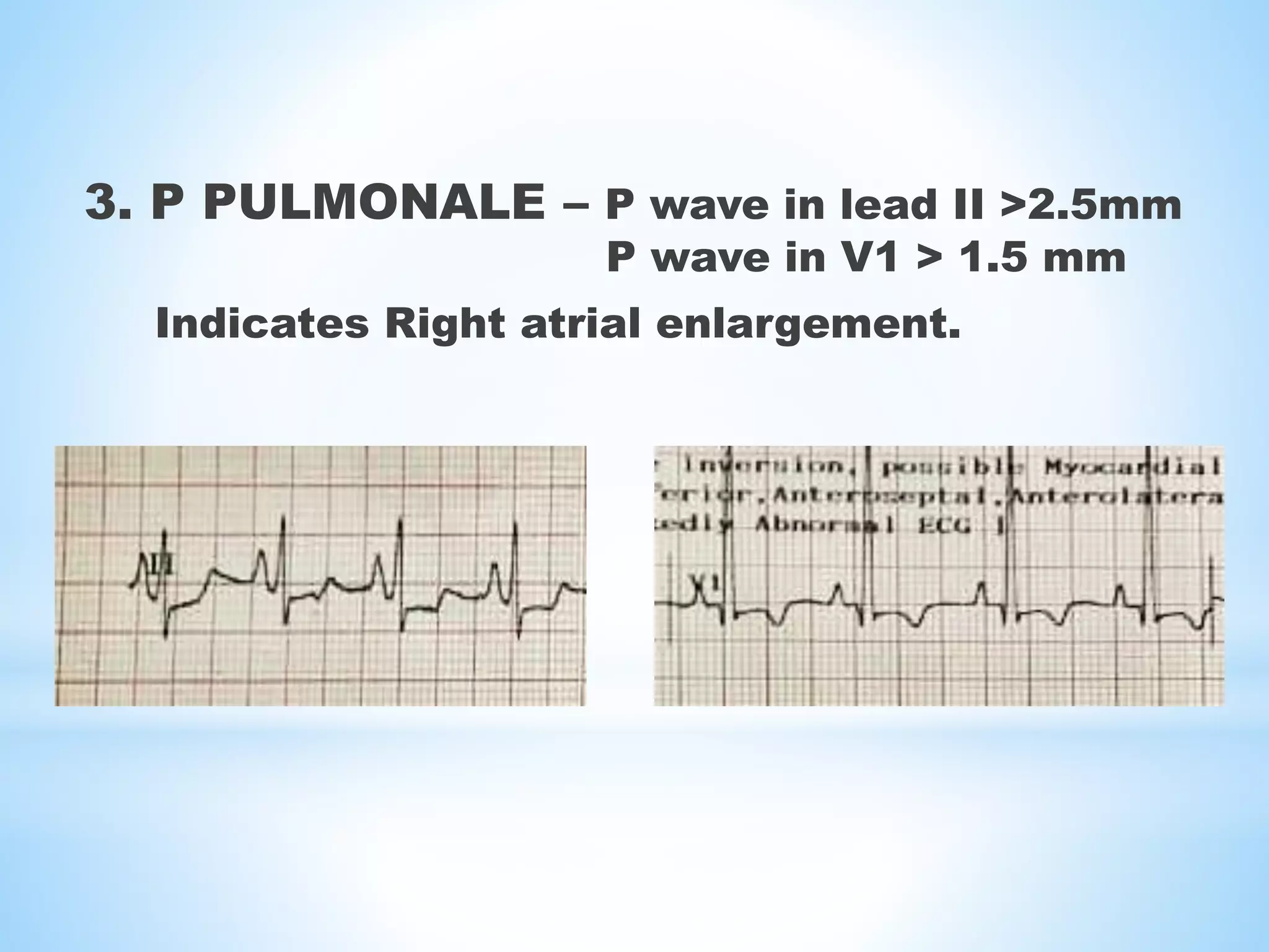 ECG OF THE WEEK final final _114428.pptx