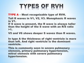 ECG OF THE WEEK final final _114428.pptx