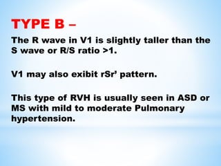 ECG OF THE WEEK final final _114428.pptx