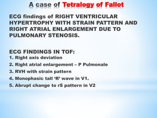 ECG OF THE WEEK final final _114428.pptx