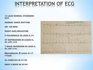 ECG OF THE WEEK final final _114428.pptx