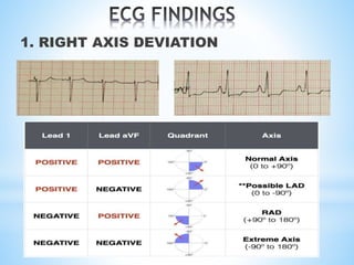 ECG OF THE WEEK final final _114428.pptx