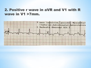 ECG OF THE WEEK final final _114428.pptx