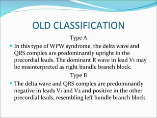 ECG: WPW Syndrome | PPT