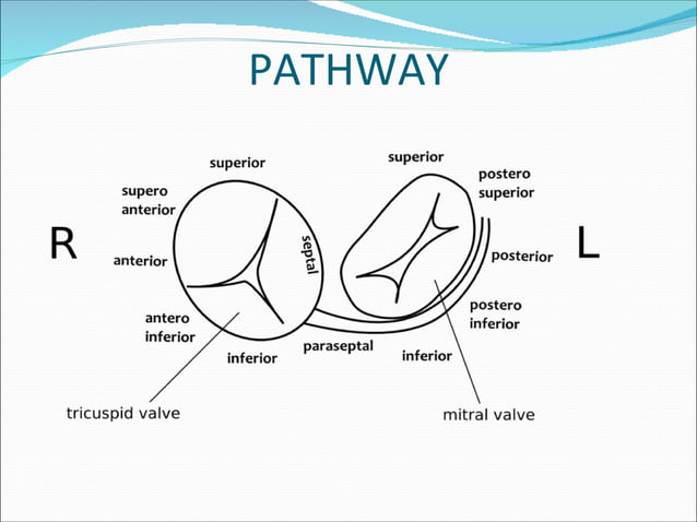 ECG: WPW Syndrome | PPT | Heart and Cardiovascular Diseases | Diseases ...