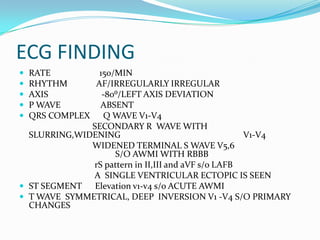 ECG: Bifascicular Block | PPTX
