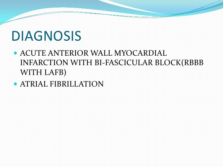 Ecg Bifascicular Block