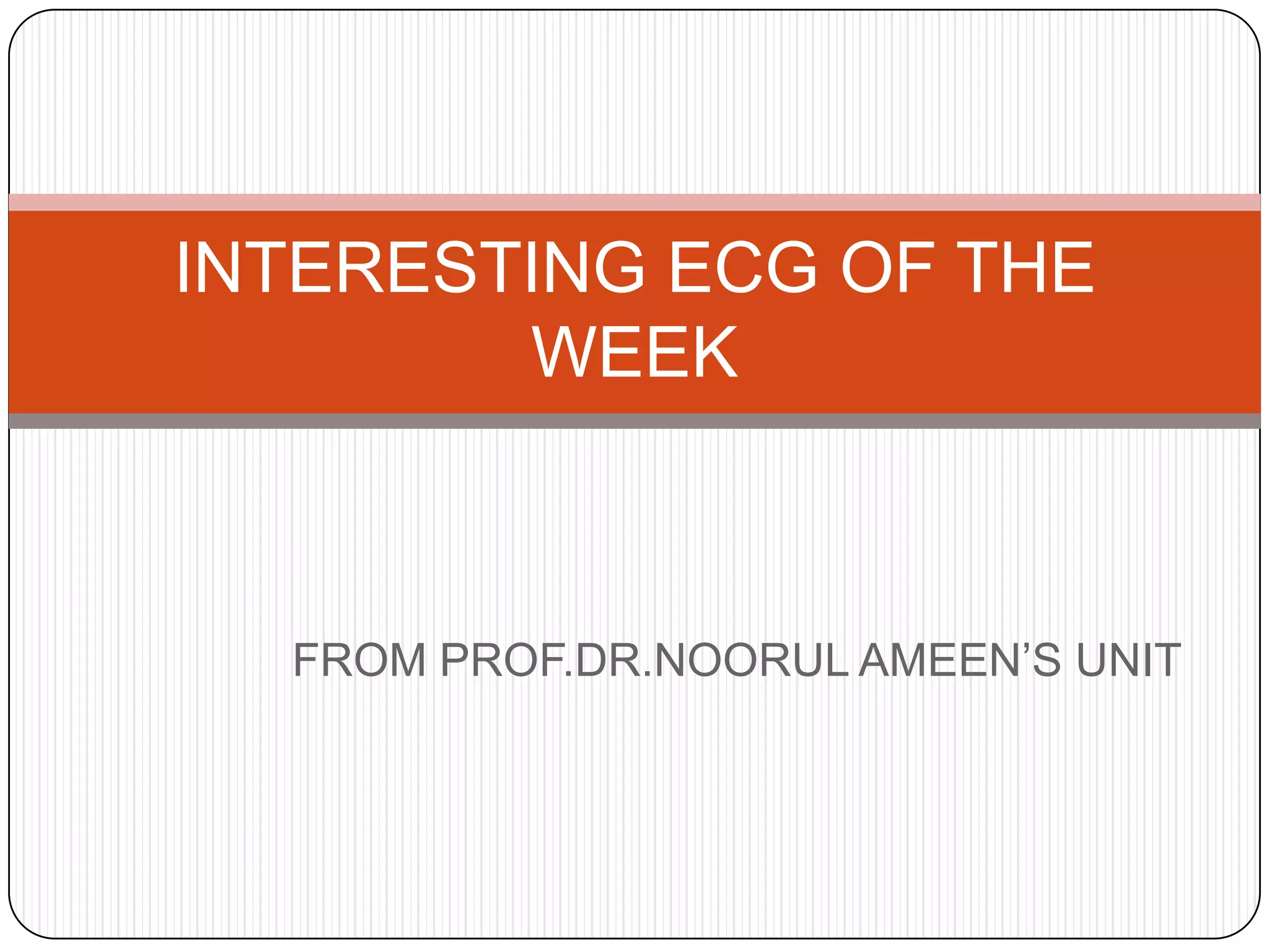 ECG: Atrial Bigeminy | PPT | Heart and Cardiovascular Diseases ...