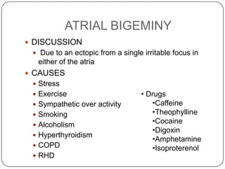 ECG: Atrial Bigeminy | PPT | Heart and Cardiovascular Diseases ...