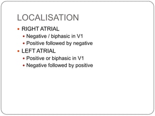 ECG: Atrial Bigeminy | PPT
