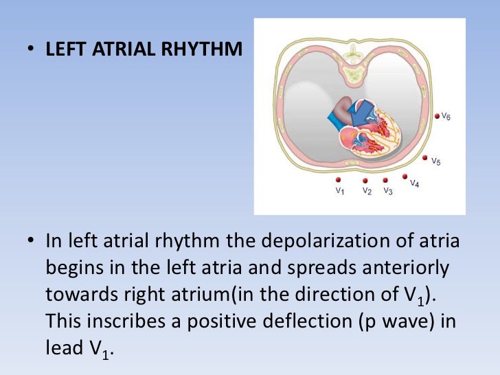ECG: Atrial Rhythm