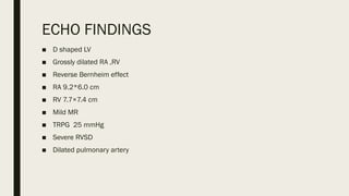ecg of the week october(Pulmonary Embolism).pptx