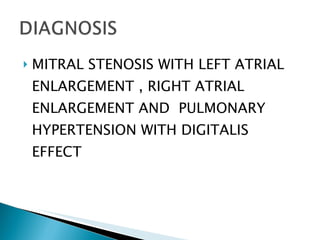 ECG: Digitalis Effect | PPT | Heart and Cardiovascular Diseases ...