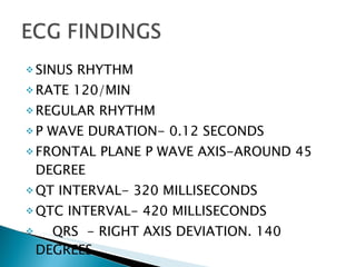 ECG: Digitalis Effect | PPT | Heart and Cardiovascular Diseases ...