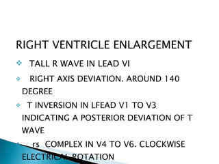 ECG: Digitalis Effect | PPT | Heart and Cardiovascular Diseases ...