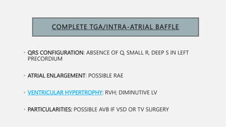 ECG ON CONGENITAL HEART DISEASE.pptx
