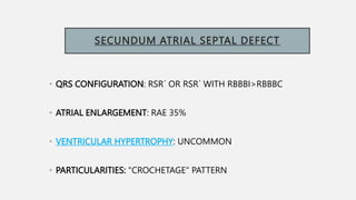 ECG ON CONGENITAL HEART DISEASE.pptx