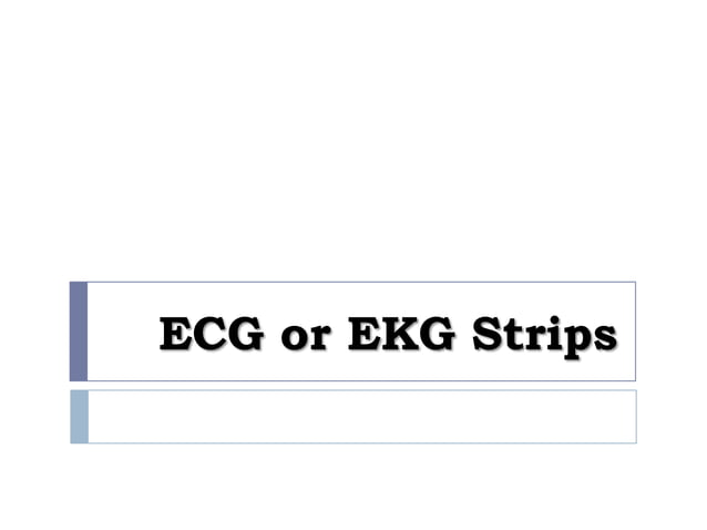 Ecg or ekg sample strips (MS Cardiovascular) | PPT
