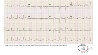 ECG Technical Overview | PDF