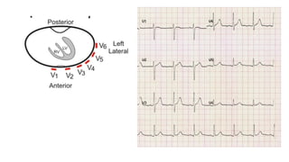 ECG Technical Overview | PDF