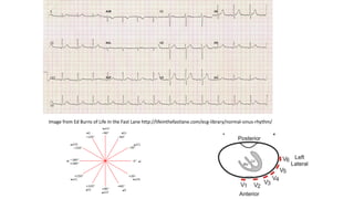 ECG Technical Overview | PDF