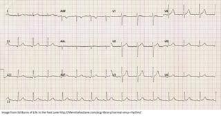 ECG Technical Overview | PDF
