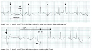 ECG Technical Overview | PDF