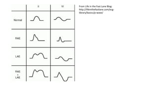 ECG Technical Overview | PDF