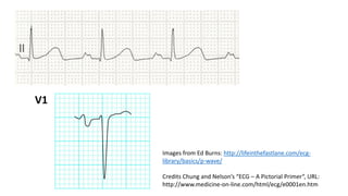ECG Technical Overview | PDF
