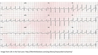 ECG Technical Overview | PDF